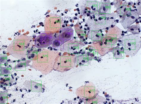 Image Example From The Cervical Cell Classification Collection