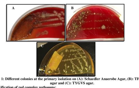 Table 1 From Identification Of Red Complex Pathogens Group From Chronic