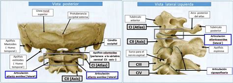 Radiografia Da Articulacao Atlanto Occipital