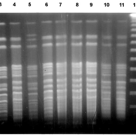 Pfge Patterns Of M Kansasii Isolates With Xba I Digestion Lanes 1 Download Scientific Diagram