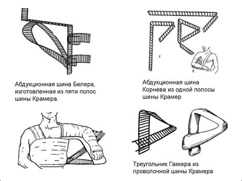 Транспортная иммобилизация - презентация онлайн