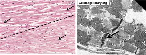 Purkinje Fibers Histology Heart Wall Histology Histology Flashcards