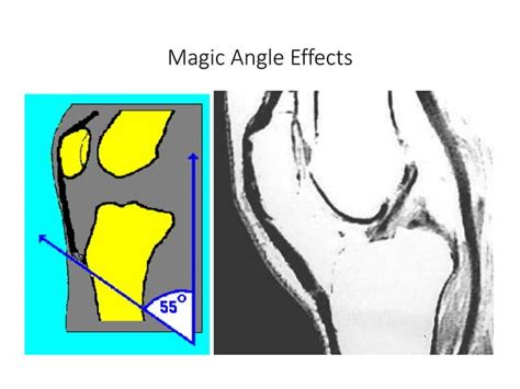 Mri Artifacts Introduction Classification Types Ppt