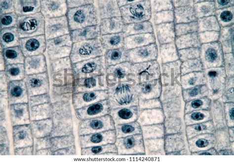 View Microscopy Mitosis Cell Root Tip Stock Photo 1114240871 Shutterstock
