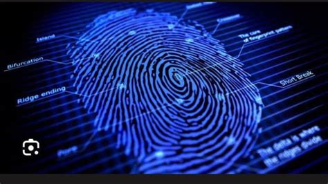 Copy Of Usage Of Fingerprint In Sex Determination 3 Pptx