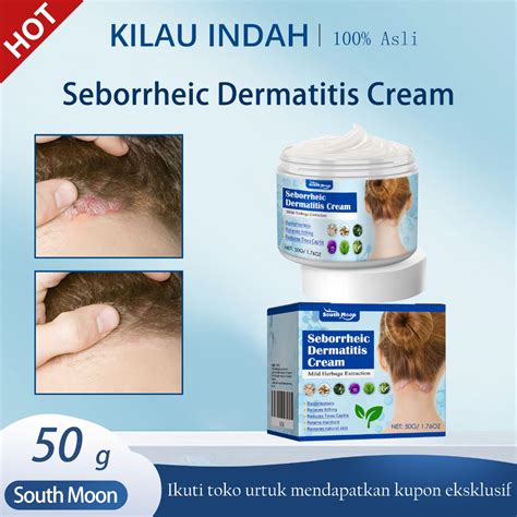 Jual South Moon Seborrheic Dermatitis Cream 50g Obat Dermatitis