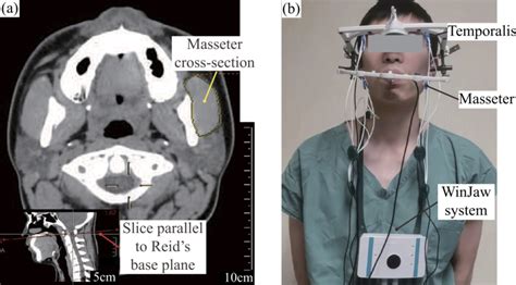Measurements Of Jaw Muscle Cross Sections Mandibular Kinematics And Download Scientific