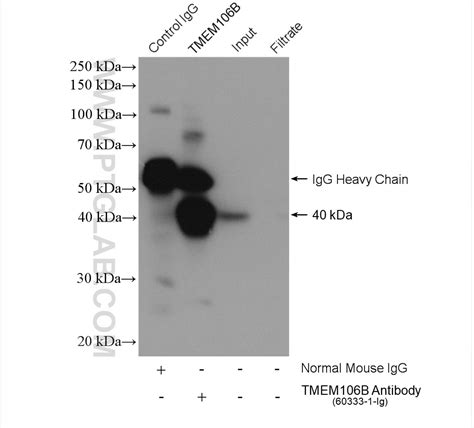 Tmem106b Antibody 60333 1 Pbs Proteintech