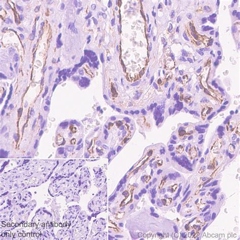 Anti Gpcr Gpr4 Antibody [epr27342 7] Ab307363 Abcam