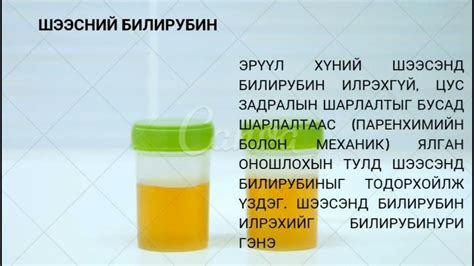 Шээсний ерөнхий шинжилгээ Youtube