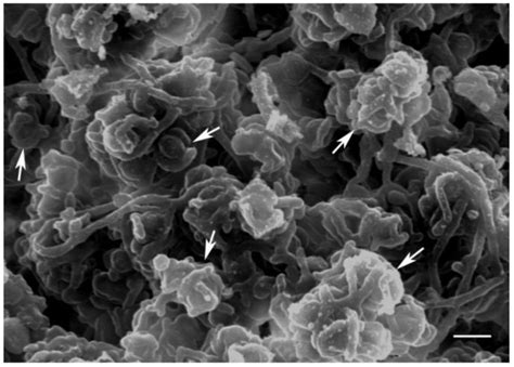 Scanning Electron Micrograph Showing Endolithic Lichens In Sandstone