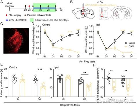 Neurobiol Dis︱浙江中医药大学陈忠课题组发现视觉相关脑区腹外侧膝状体的不同类型神经元介导红、绿光对疼痛的不同调制作用 知乎