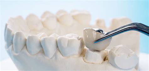 All To Know About Partial Crown Healing Clinic Turkey