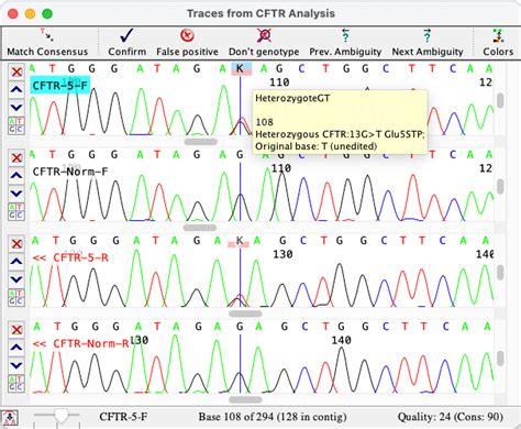 mutation detection software for sanger sequencing codoncode aligner