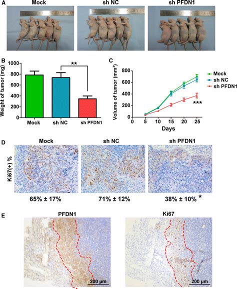 Silencing Of Pfdn1 Inhibits Tumorigenicity In Vivo A Photographs Of Download Scientific