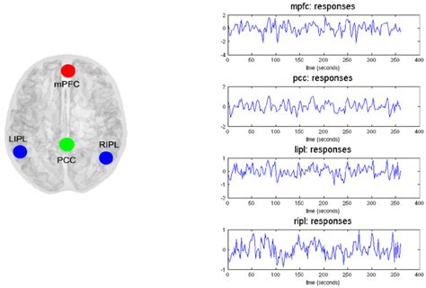 Four Nodes Of Dynamic Causal Modeling Dcm Model The Left Panel Download Scientific Diagram