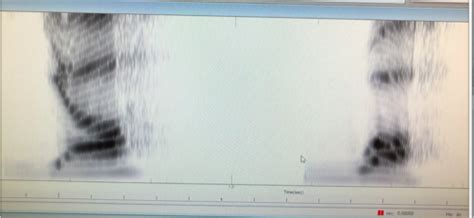 Voice And Resonance Exam 3 Spectrogram Information Flashcards Quizlet