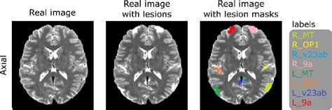 Figure 1 From Icam Interpretable Classification Via Disentangled Representations And Feature