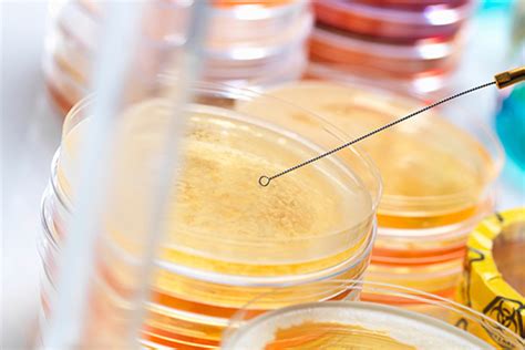 microbial whole genome sequencing novogene