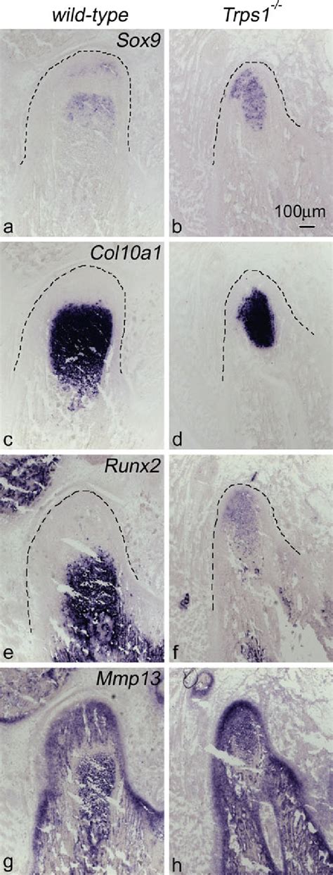 abnormal cartilage gene expression in trps1 mutants at e18 5 in situ
