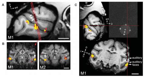 Targeting An Fmri Identified Face Patch For Single Unit Recording Download Scientific Diagram