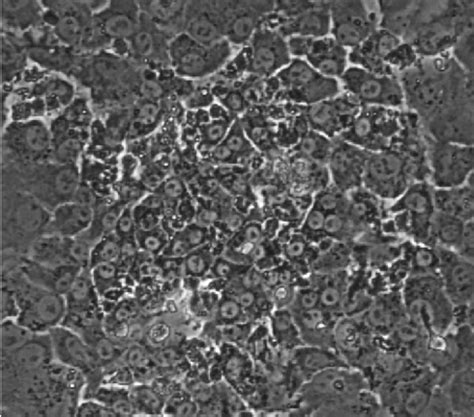 1 Human Foetal Hepatocytes 2 Days After Isolation Phase Contrast