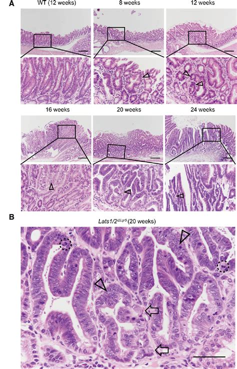 Figure 1 From Yap Taz Initiates Gastric Tumorigenesis Via Upregulation Of Myc Semantic Scholar