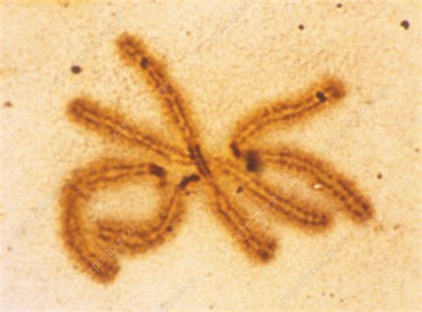 Mitosis Light Micrograph Stock Image C057 5695 Science Photo Library