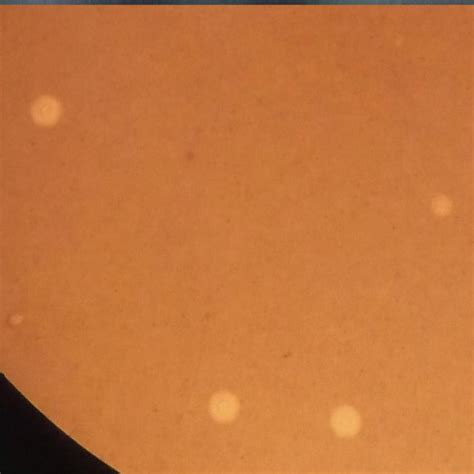 Picture Of Cryptococcus Neoformans In India Ink Download Scientific Picture Of Cryptococcus Neoformans In India Ink Download Scientific