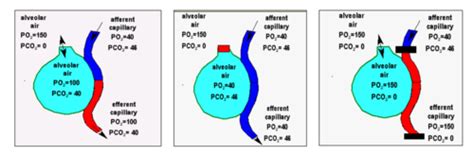 Physio Essay 33 The Characteristics Of The Lung Circulation The