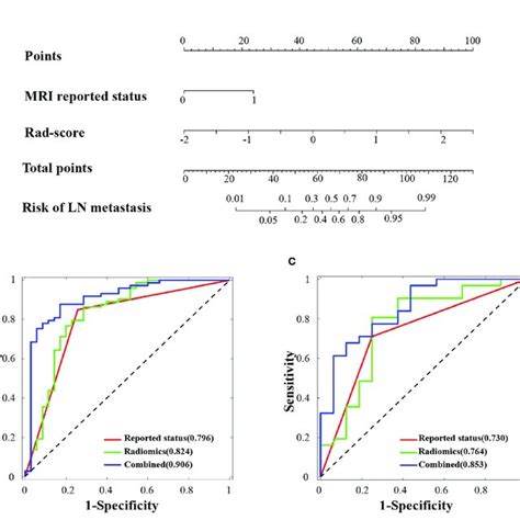 Radiomics Nomogram Developed And Receiver Operating Characteristic