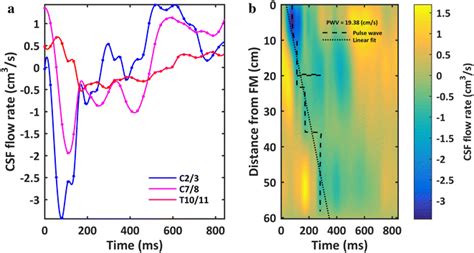 A Subject Specific CSF Flow Waveforms Measured At C2 3 C7 T1 And Download Scientific Diagram