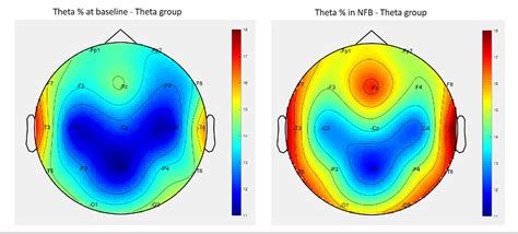 Figure 1 From The Effects Of Theta EEG Neurofeedback On The Consolidation Of Spatial Memory