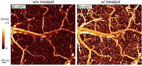 Flow Quantification Using Doppler Oct A Flow Mapping Before Download Scientific Diagram