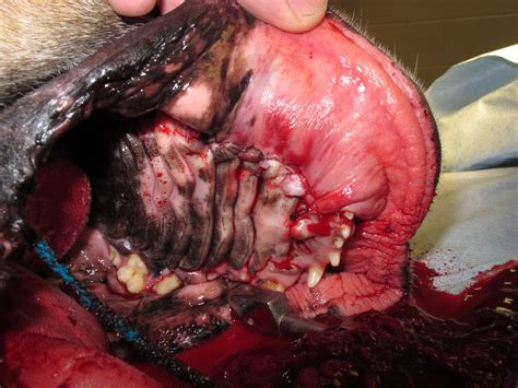 Oral Maxillectomy — Dr Julius M Liptak
