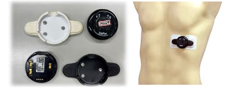 Schematic Illustration Of The Bioharness 30 Biopatch Device And Its