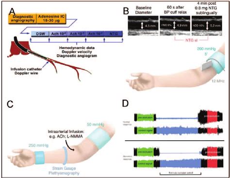Different Invasive And Noninvasive Methodologies To Assess Endothelial