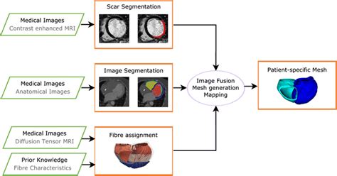 A Schematic Of A Workflow For The Generation Of Patient Specific