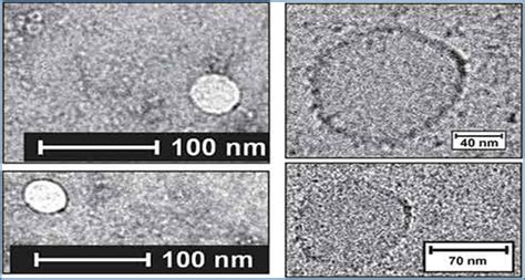 A Comprehensive Method For Identification Of Suitable Reference Genes In Extracellular Vesicles
