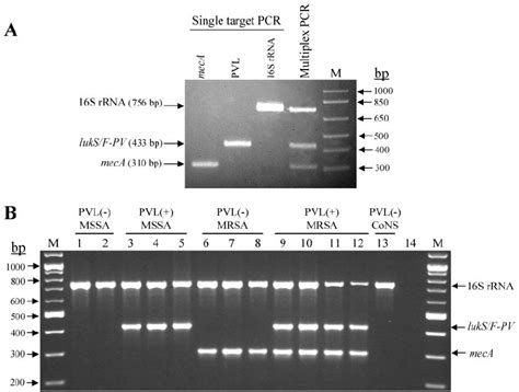 New Multiplex Pcr Assay For Simultaneous Detection Of Pvl And Download Scientific Diagram