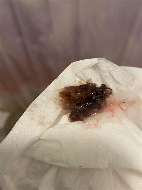 Sinus Pressure 0 Scrolller