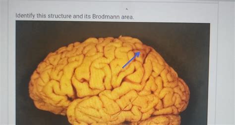 Solved Identify This Structure And Its Brodmann Area