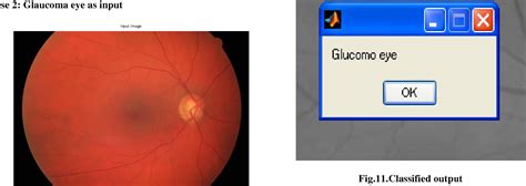 figure 8 from feature extraction using contourlet transform for
