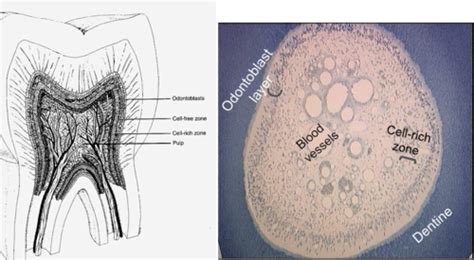Op Periapical Pathology Flashcards Quizlet