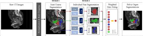 Figure From Pelvic Organ Segmentation Using Distinctive Curve Guided Fully Convolutional