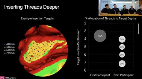 Neuralink Will Offer Telepathy And Then Brain Control Of Teslabots