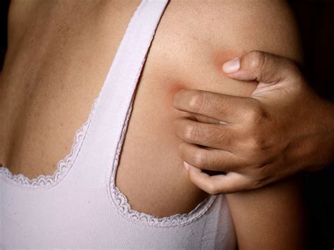 Itchy Red Rash Swollen Lips