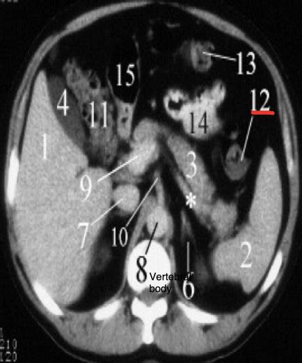 Abdominal CT Diagram Quizlet