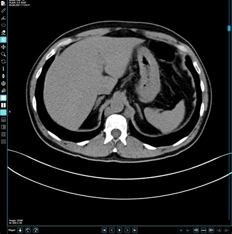Best DICOM Viewers For Windows MacOS Web Mobile
