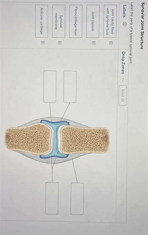 Solved Synovial Joint Structure Label The Parts Of A Typical Synovial 1 Answer